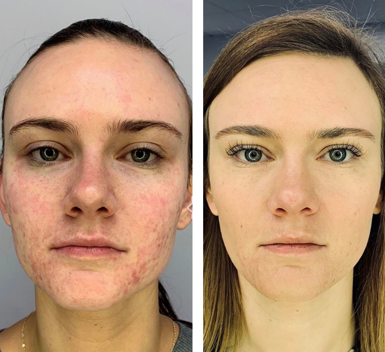 Oral Surgeon North Vancouver BC | Oral Surgery